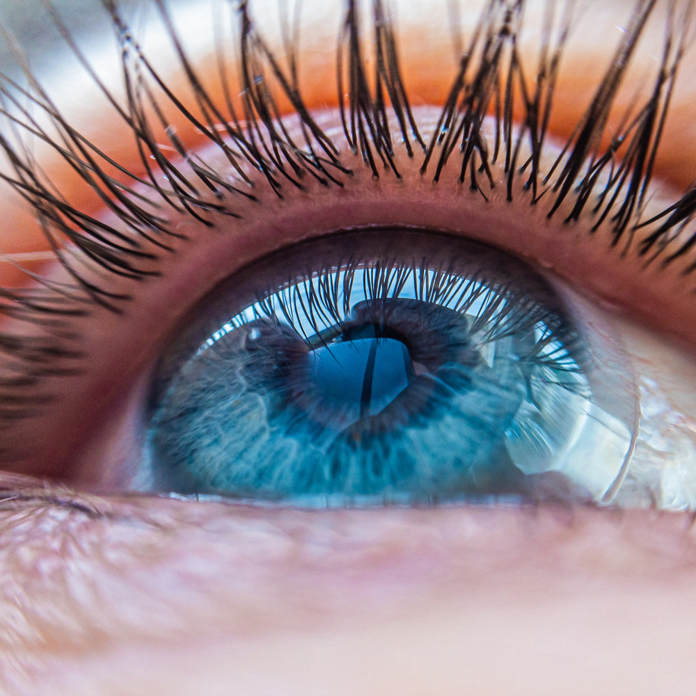 When to Say No to Contact Lenses (Active) – Optical Training Institute