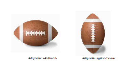 Top Contact Lenses for Astigmatism: A Comprehensive Review