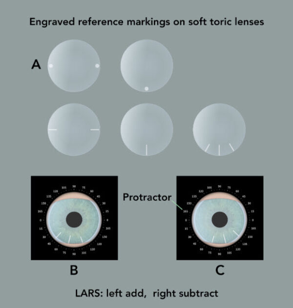 Top Contact Lenses for Astigmatism: A Comprehensive Review