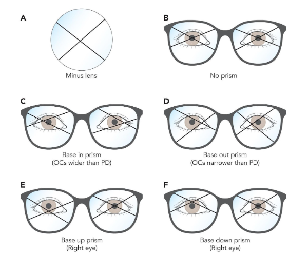 Mastering Prentice's Rule - A Complete Guide