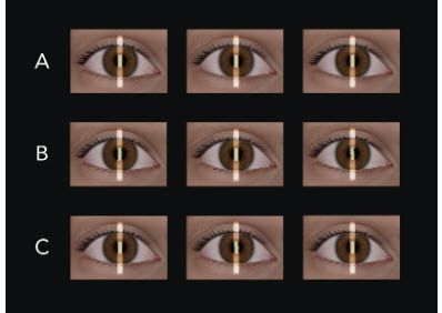 Soft Lens Fitting and Evaluation: Comprehensive Guide by experts